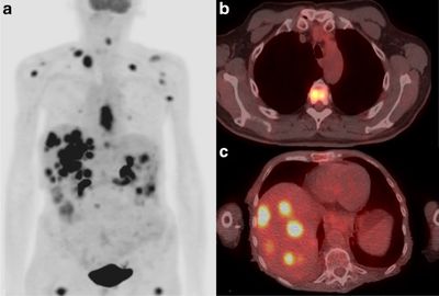 Application of ionising radiation in healthcare - ICRPaedia